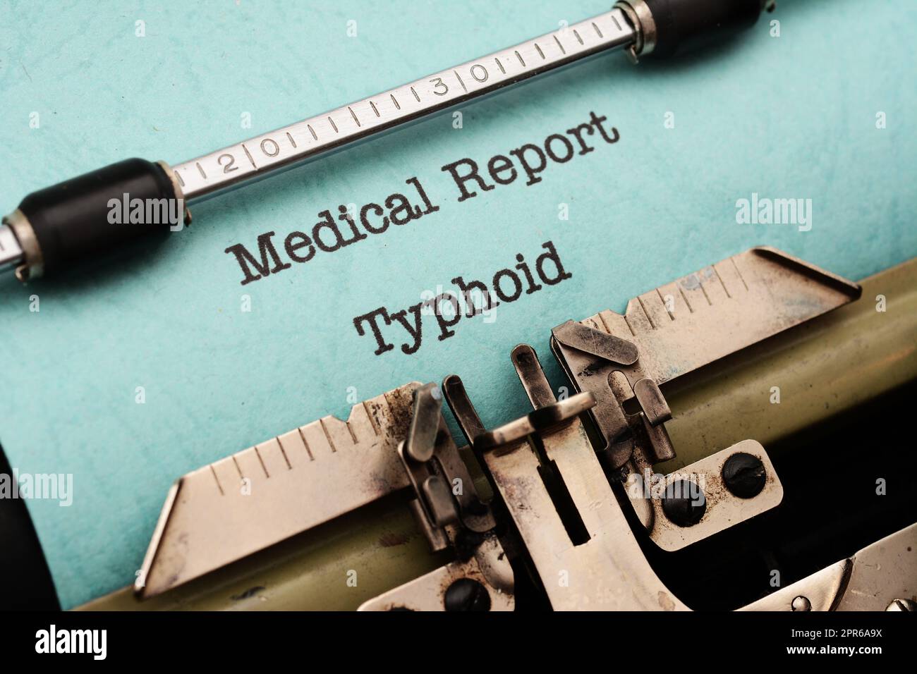 Typhus fever -Fotos und -Bildmaterial in hoher Auflösung – Alamy