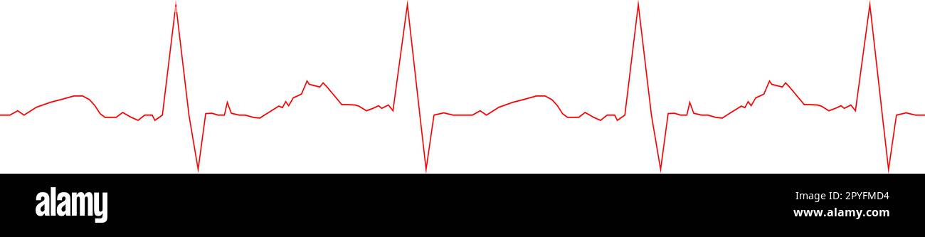 Elektrokardiogramm-Vorlage. Herzschlagdiagramm. EKG-Karte isoliert auf ...