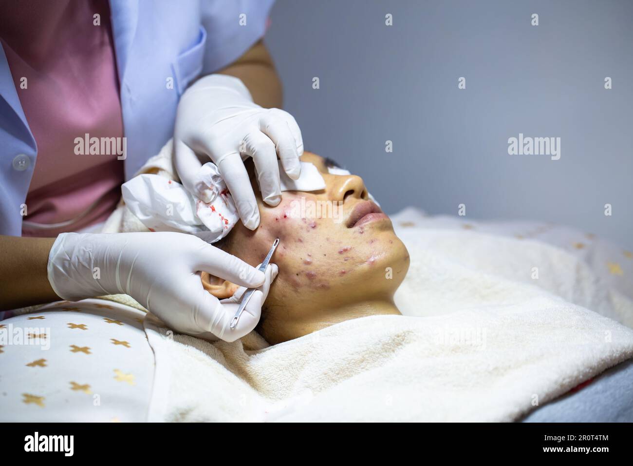 Inflammation depression -Fotos und -Bildmaterial in hoher Auflösung – Alamy