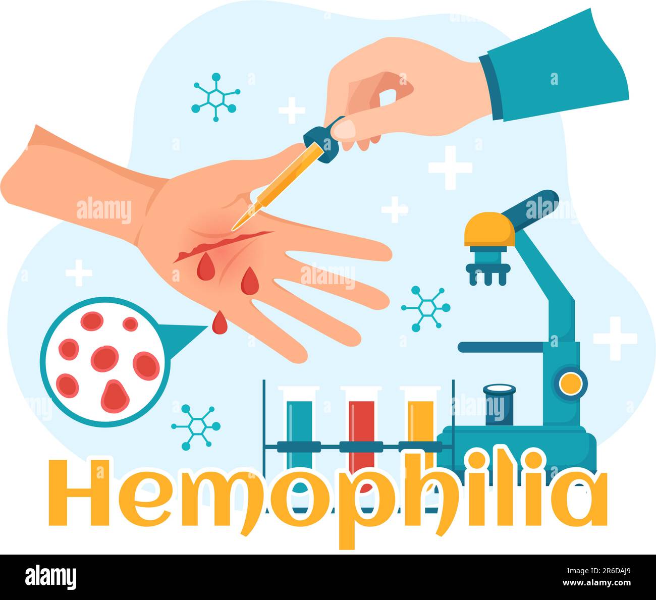 Hämophilie-Vektor-Illustration mit Arzt-Untersuchung verletzter Knie ...
