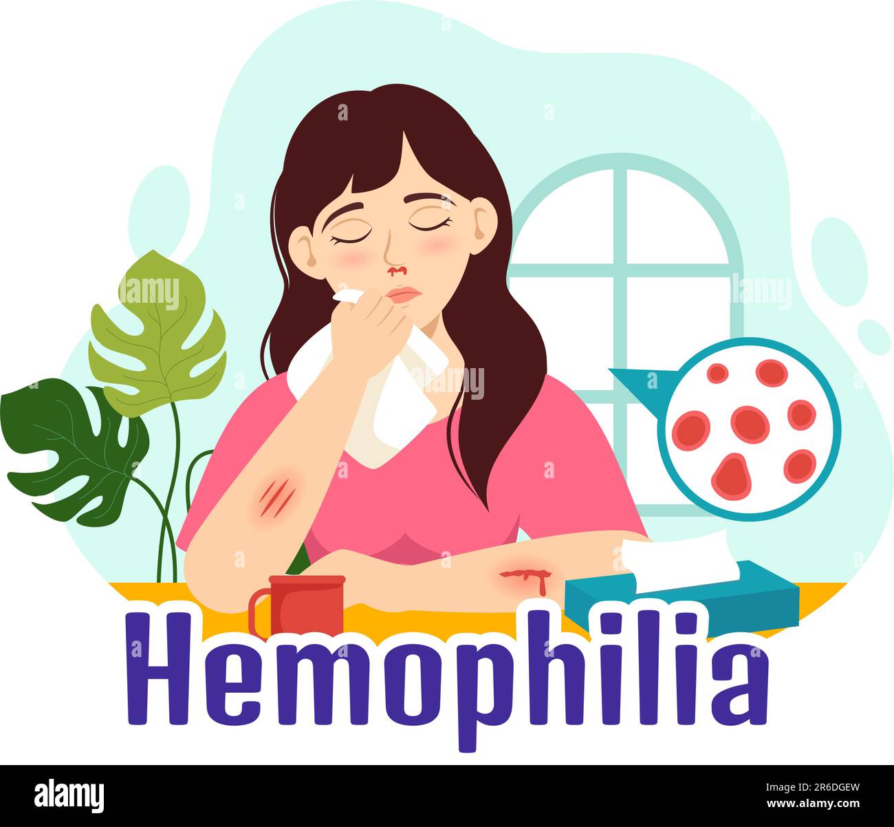 Hämophilie-Vektor-Illustration mit Arzt-Untersuchung verletzter Knie ...