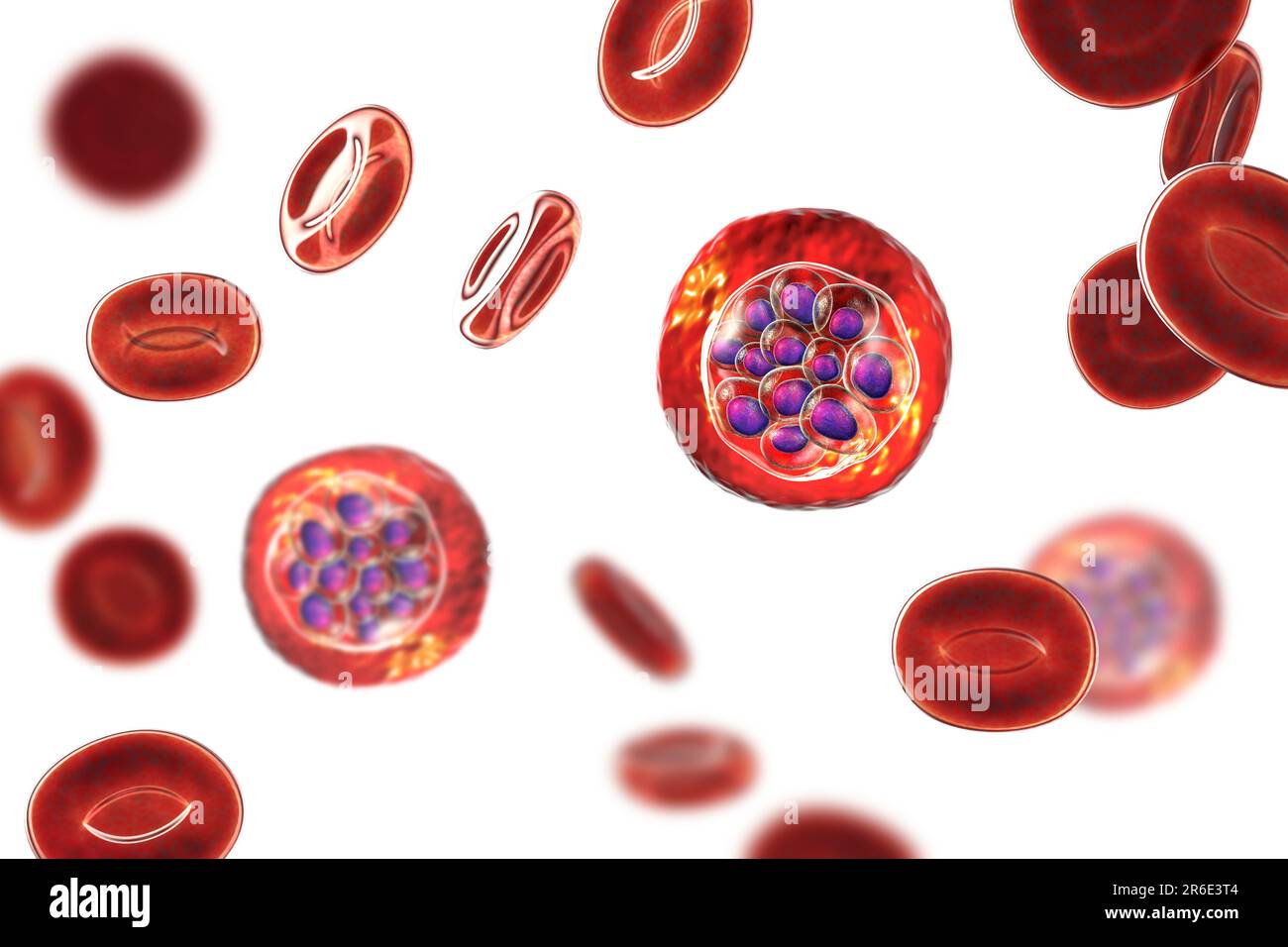 Protozoan Plasmodium vivax in roten Blutkörperchen, Computergrafiken. P. vivax ist der Erreger ...