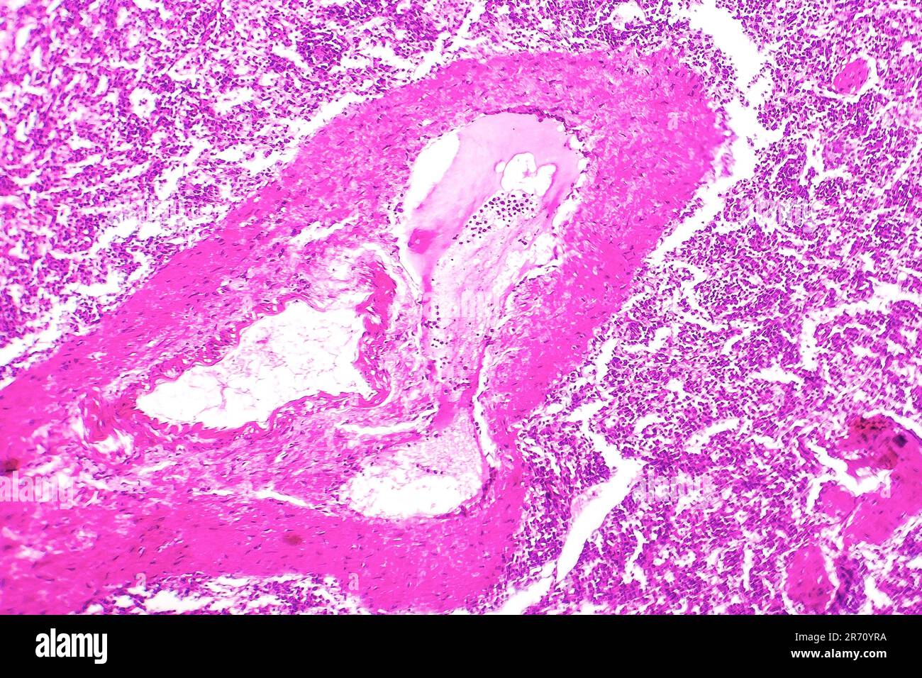 Hematoxylin and eosin stain -Fotos und -Bildmaterial in hoher Auflösung – Alamy