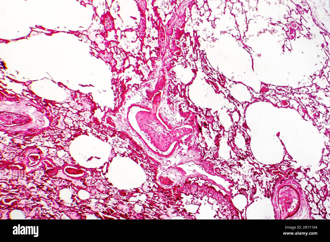 Hematoxylin and eosin stain -Fotos und -Bildmaterial in hoher Auflösung – Alamy