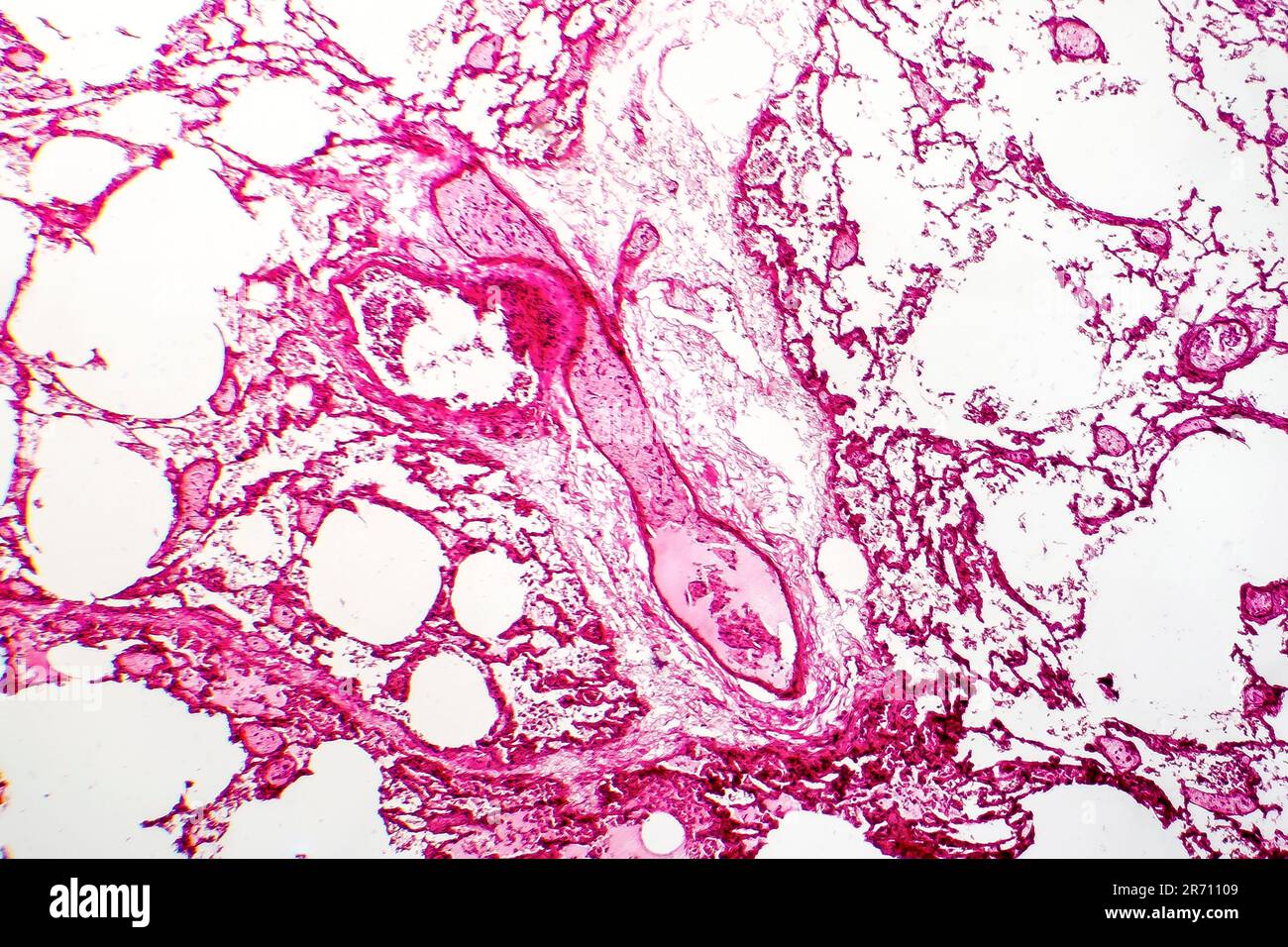Hematoxylin and eosin stain -Fotos und -Bildmaterial in hoher Auflösung – Alamy