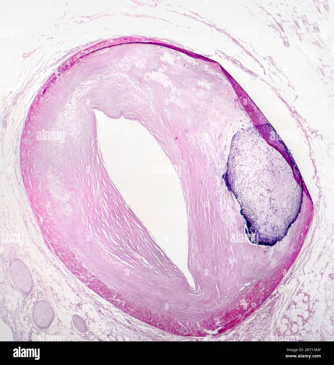 Hematoxylin and eosin stain -Fotos und -Bildmaterial in hoher Auflösung – Alamy
