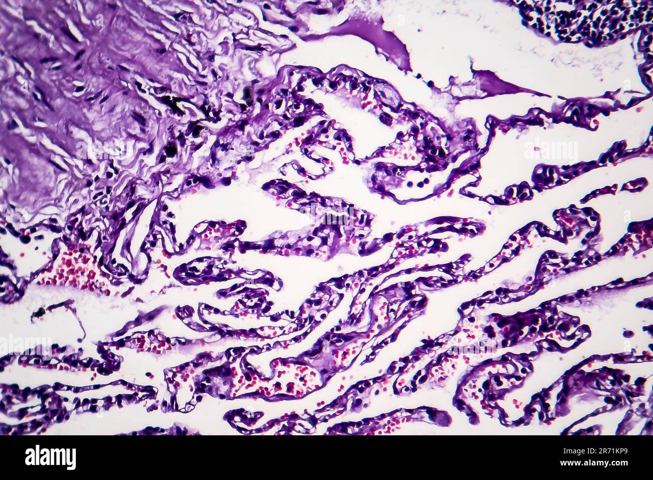 Menschliche lungen anatomie und histologie -Fotos und -Bildmaterial in ...