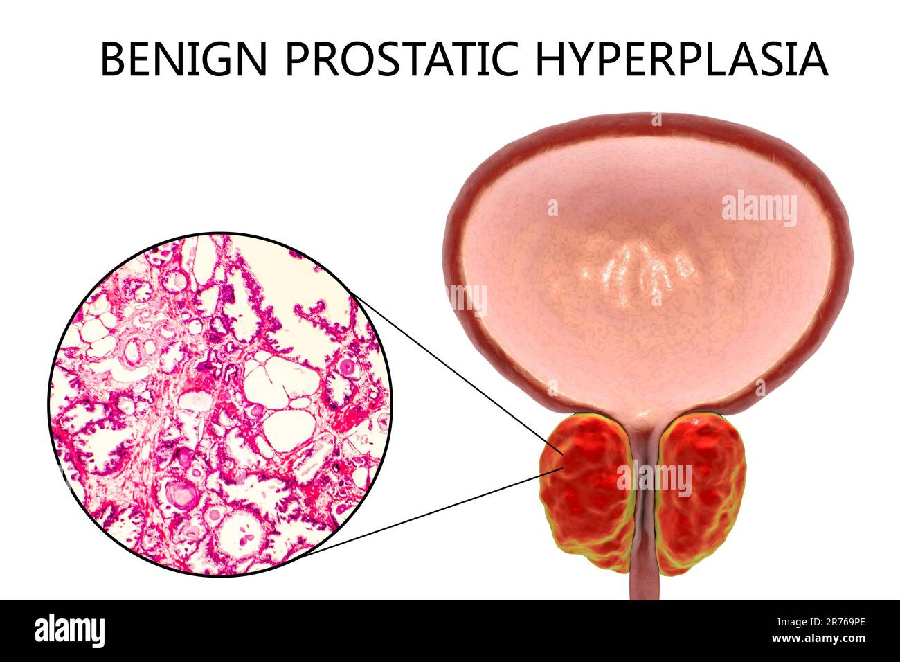 Illustration und lichtmikroskopische aufnahme -Fotos und -Bildmaterial in hoher Auflösung – Alamy
