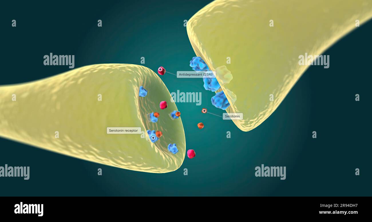 Selektive Serotonin-Wiederaufnahmehemmer (SSRI) sind ein ...