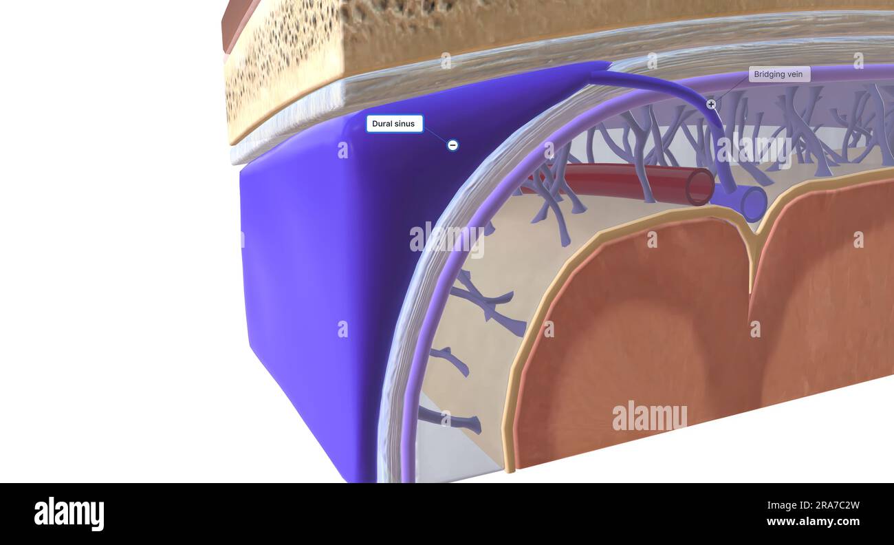 Die drei Schichten der Meningen sind Dura mater, Arachnoid mater und ...