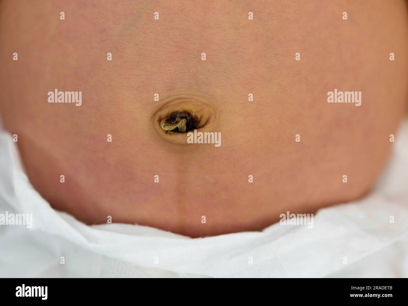 Nabel mädchen -Fotos und -Bildmaterial in hoher Auflösung – Alamy