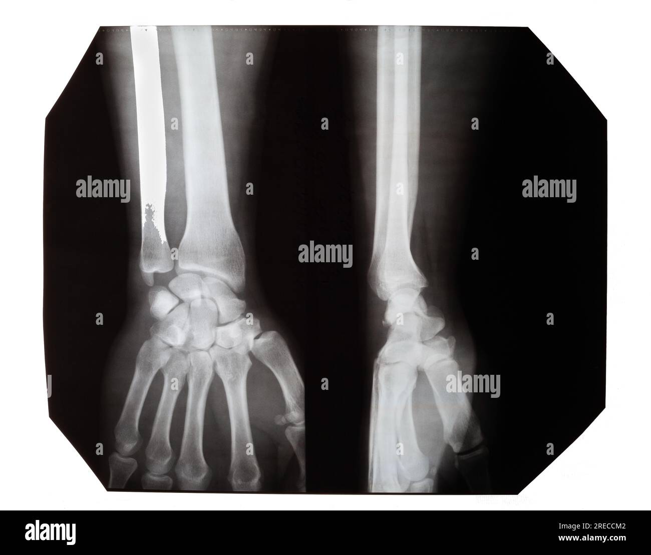 Huesos del cuerpo -Fotos und -Bildmaterial in hoher Auflösung – Alamy