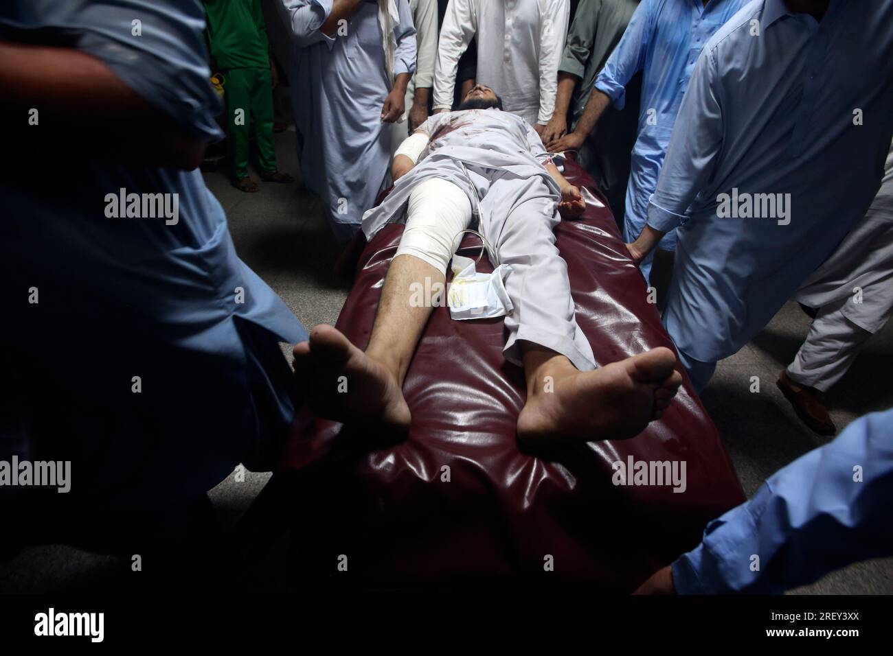 People transport an injured victim of a powerful bomb upon arrival at a ...