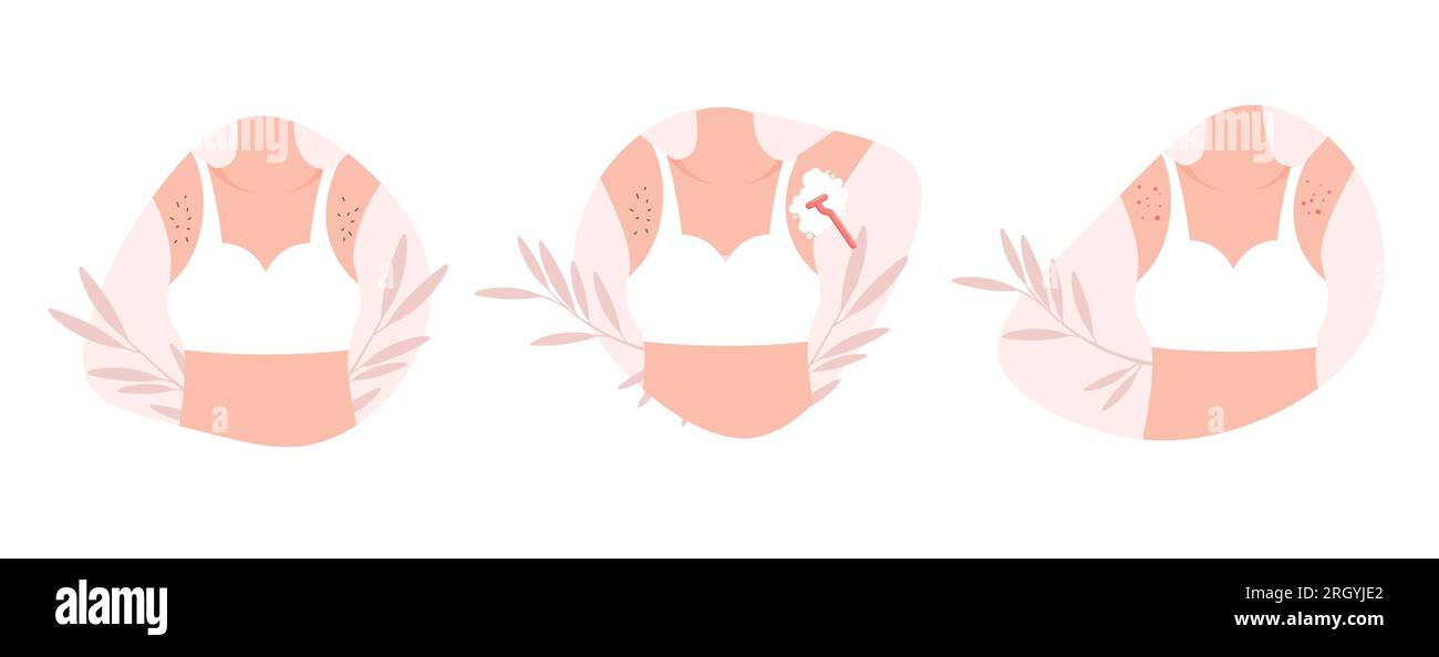 Behaarte achselhöhle weiblich Ausgeschnittene Stockfotos und -bilder ...