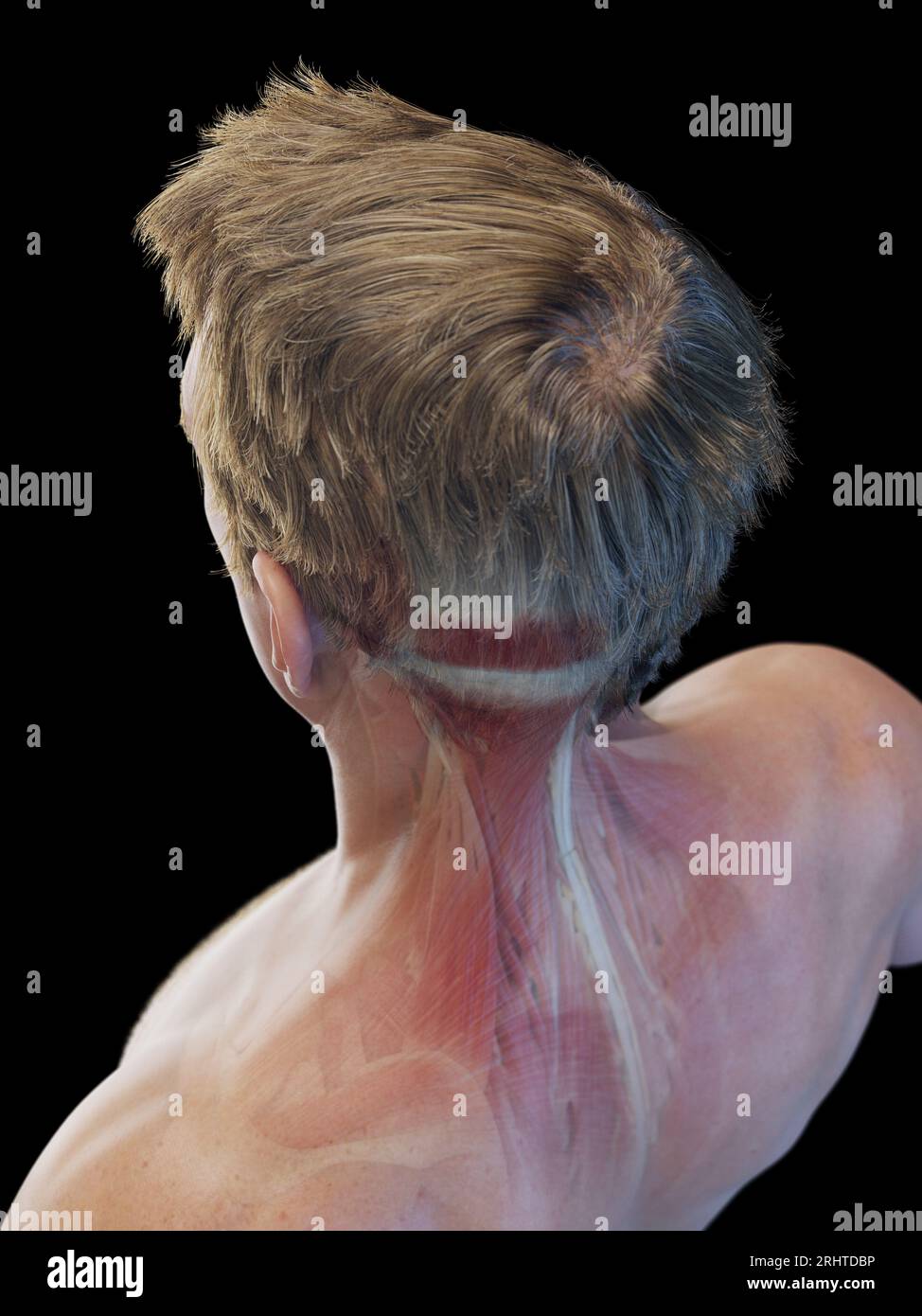Human neck muscles sternocleidomastoid illustration -Fotos und ...