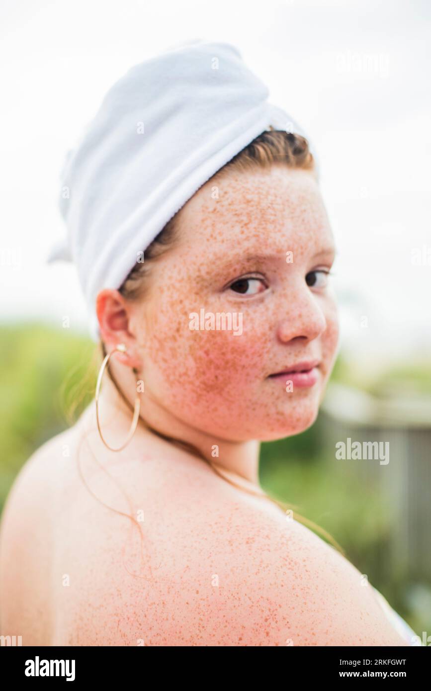 Freckled face -Fotos und -Bildmaterial in hoher Auflösung – Alamy
