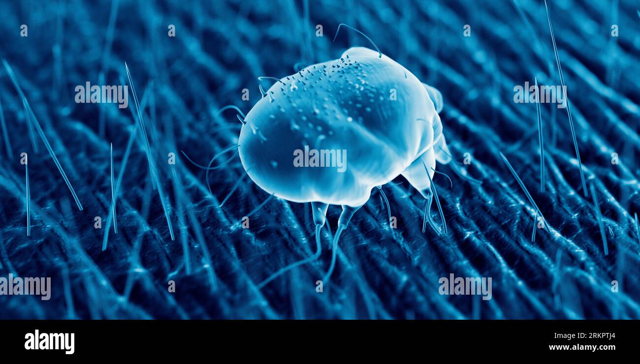 Scabies Milbe auf menschlicher Haut, Illustration Stockfotografie - Alamy
