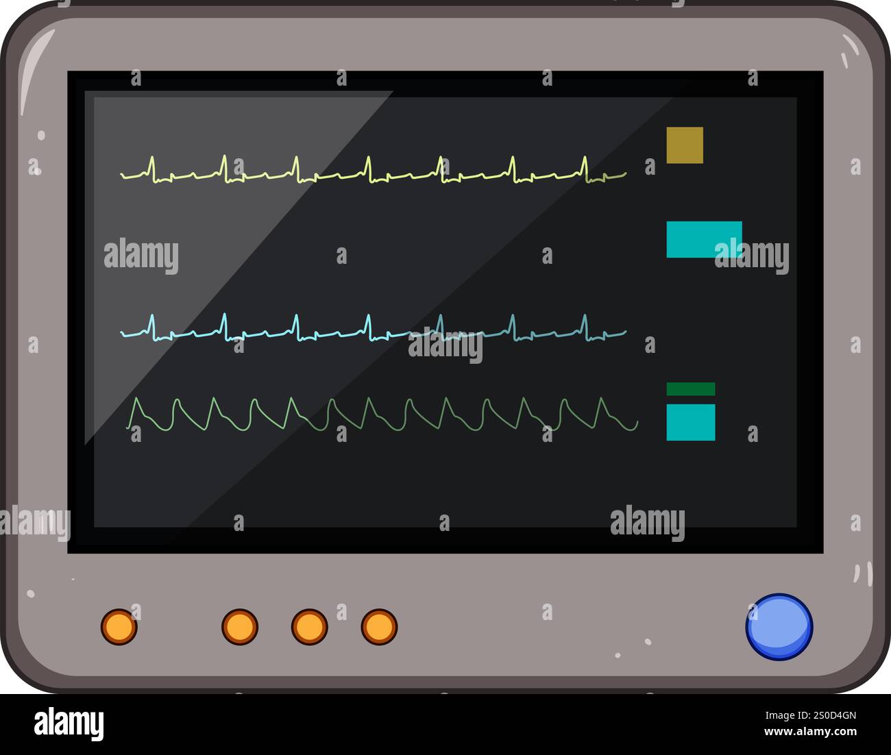 ekg-Monitor-Cartoon im Elektrokardiogramm. Elektroden Kurve, Diagnose ...
