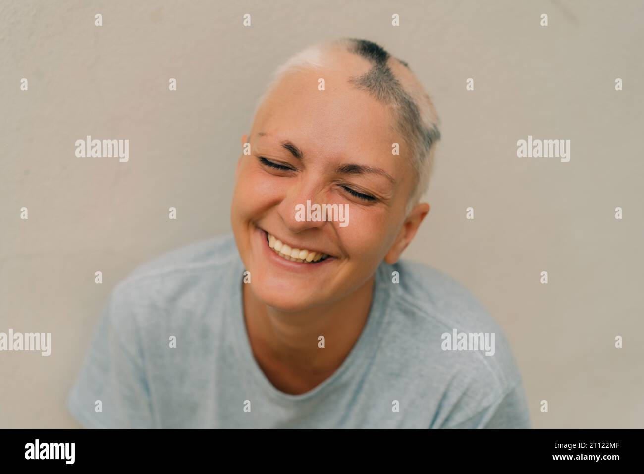 Diffuser haarausfall -Fotos und -Bildmaterial in hoher Auflösung – Alamy