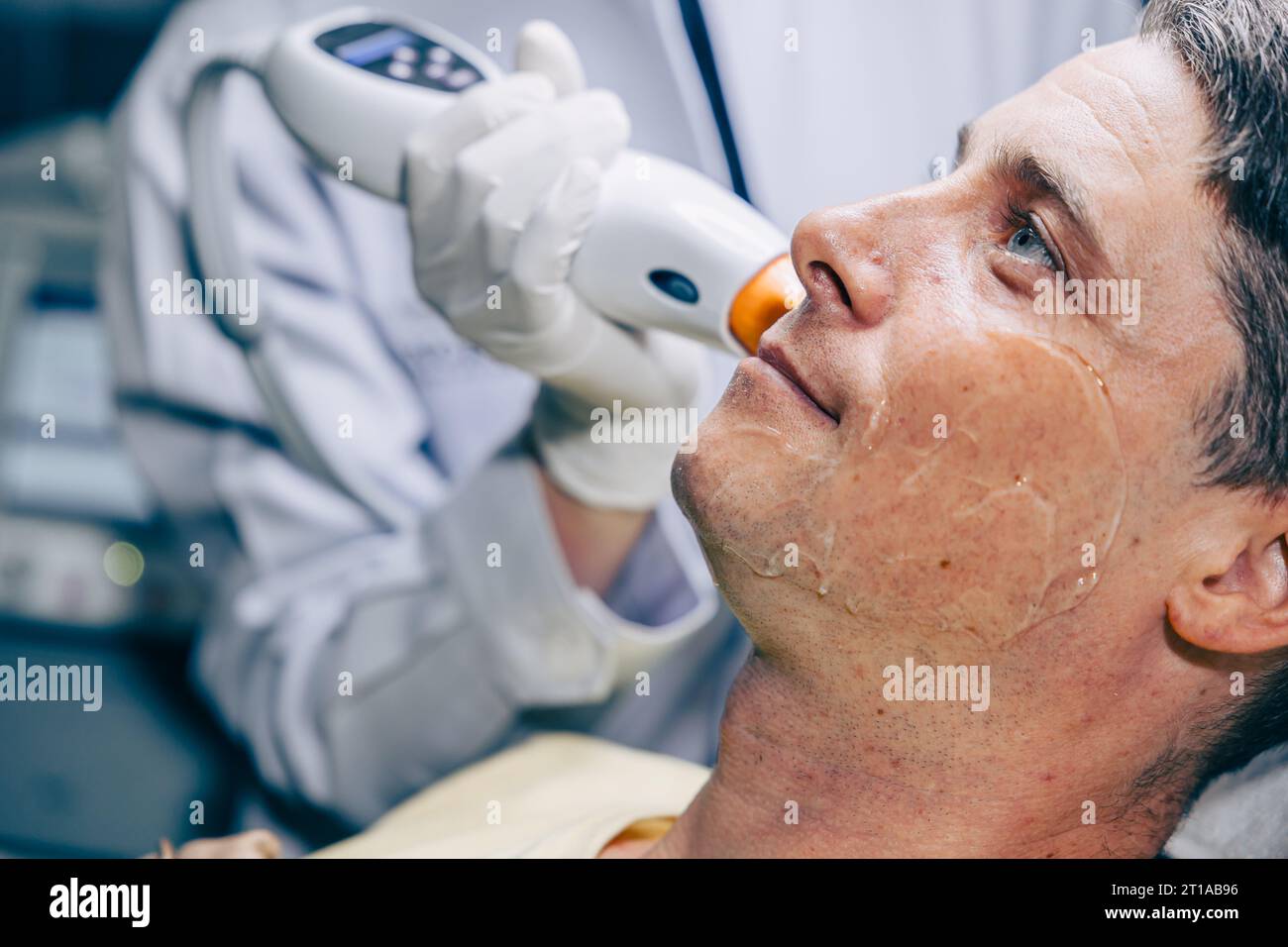 Pigmentierung laser -Fotos und -Bildmaterial in hoher Auflösung – Alamy