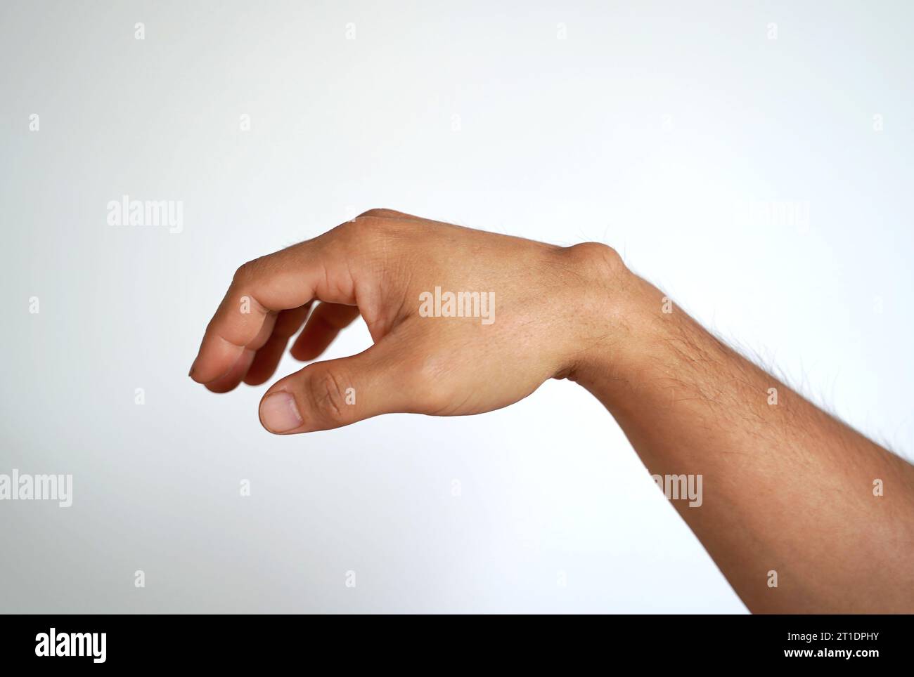 Ganglion cyst -Fotos und -Bildmaterial in hoher Auflösung – Alamy