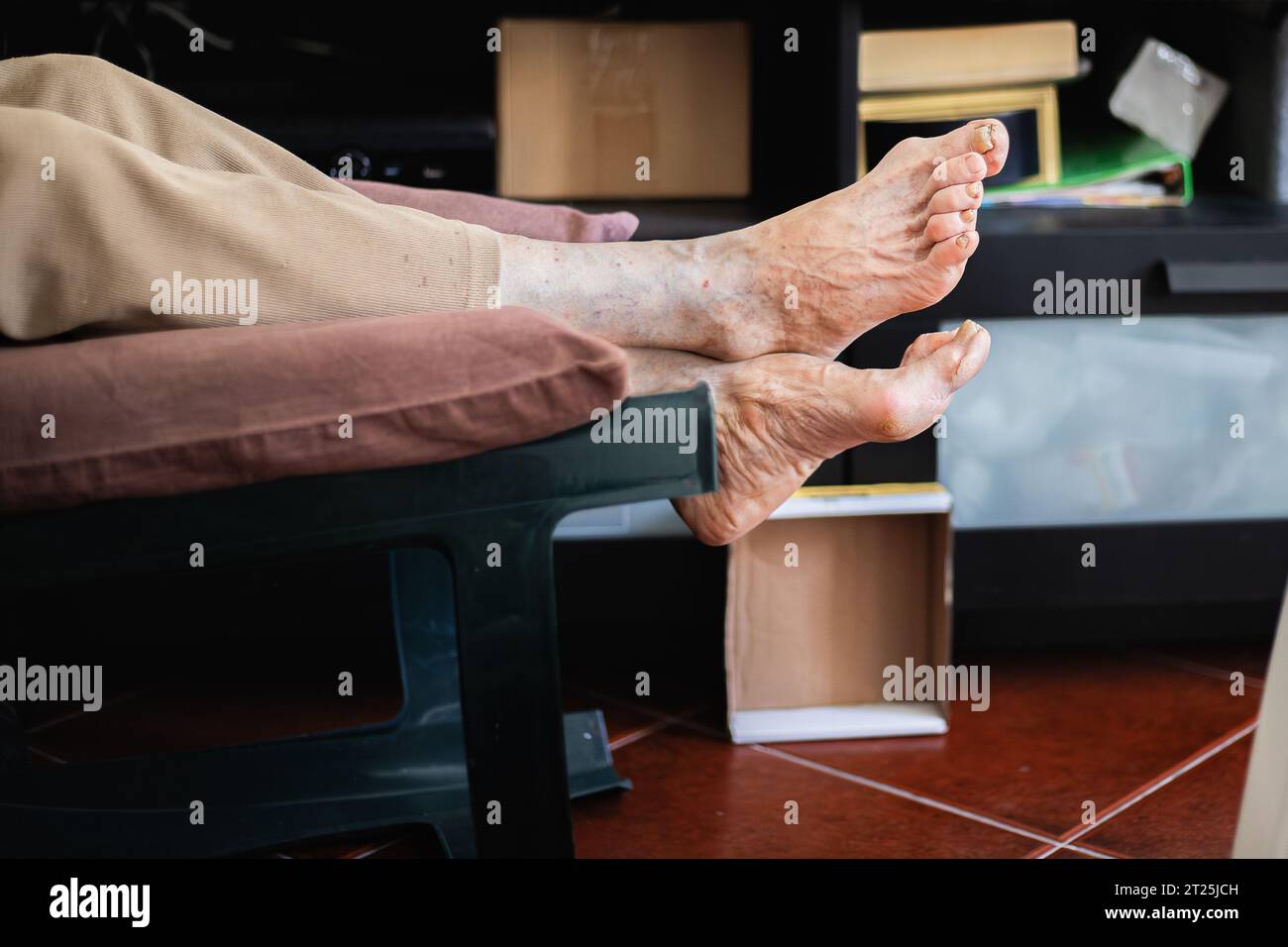 Hässliche füße -Fotos und -Bildmaterial in hoher Auflösung – Alamy