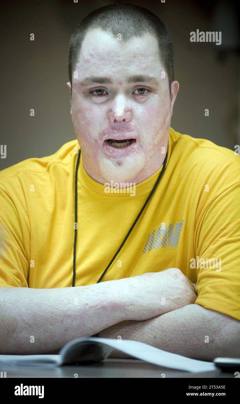 Kesselexplosion, Brandopfer, Center for the Intrepid, Emory S. Land ...