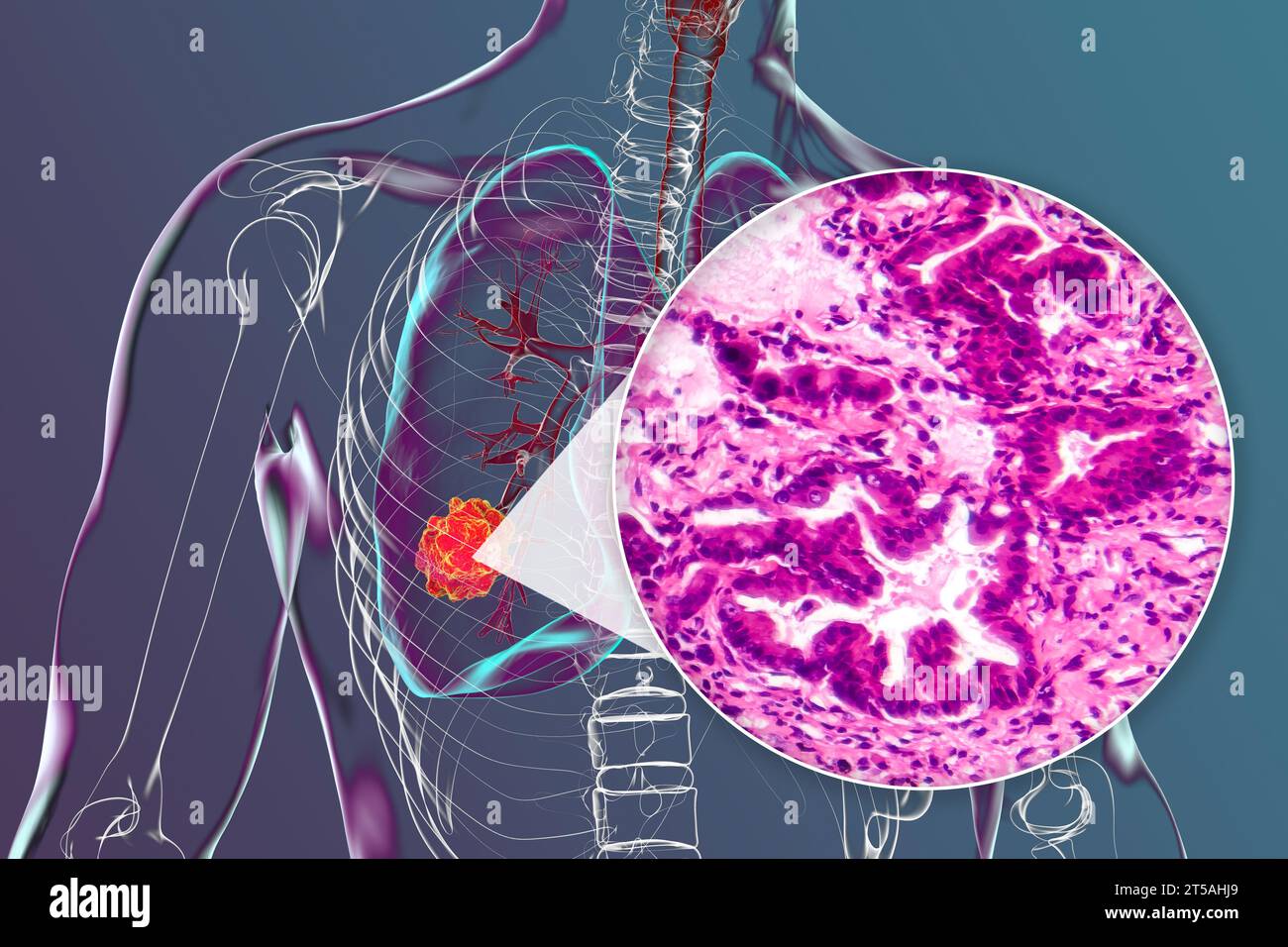 Menschliche lungen anatomie und histologie -Fotos und -Bildmaterial in ...