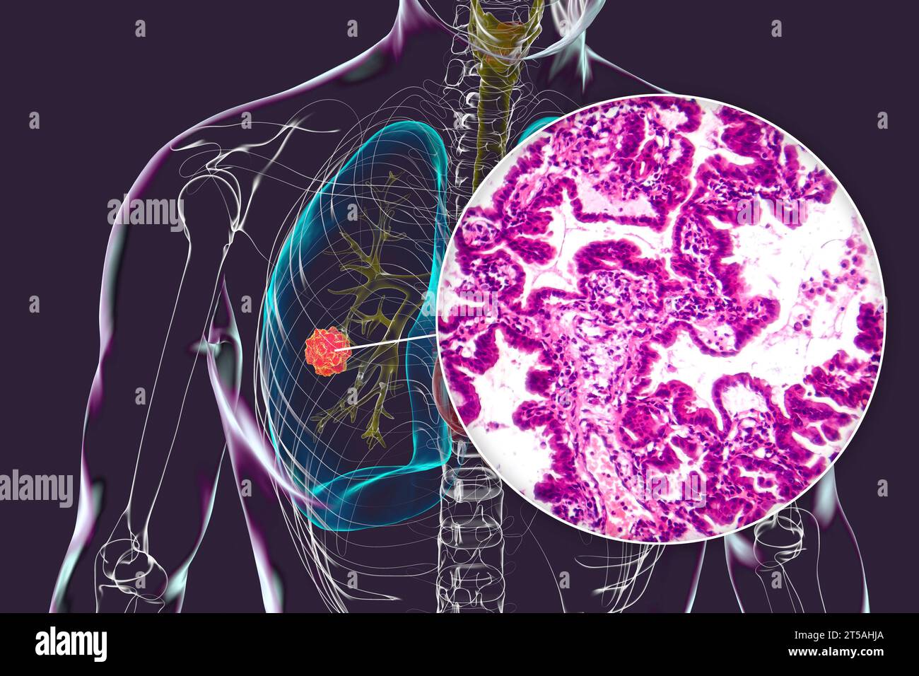 Menschliche lungen anatomie und histologie -Fotos und -Bildmaterial in ...