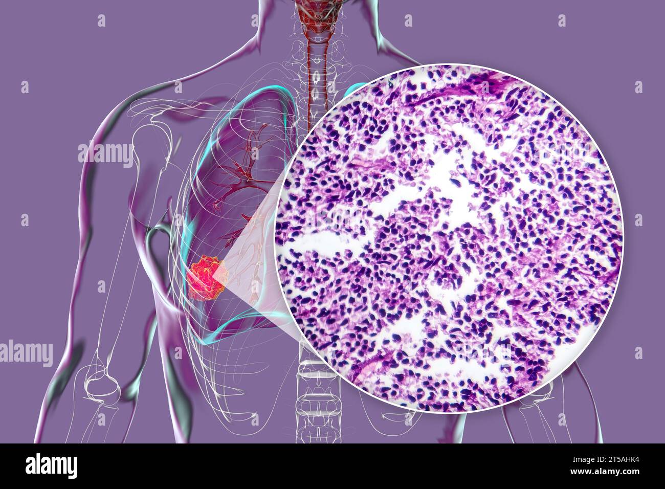 Human lung anatomy and histology -Fotos und -Bildmaterial in hoher ...