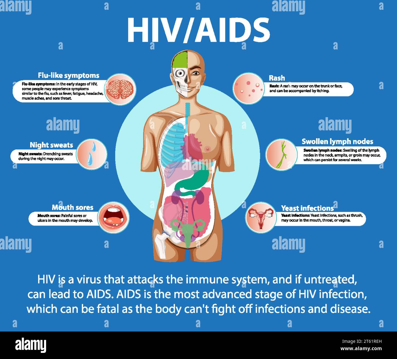 Abbildung der Auswirkungen von HIV/AIDS auf Gehirn, Mund, Haut und ...