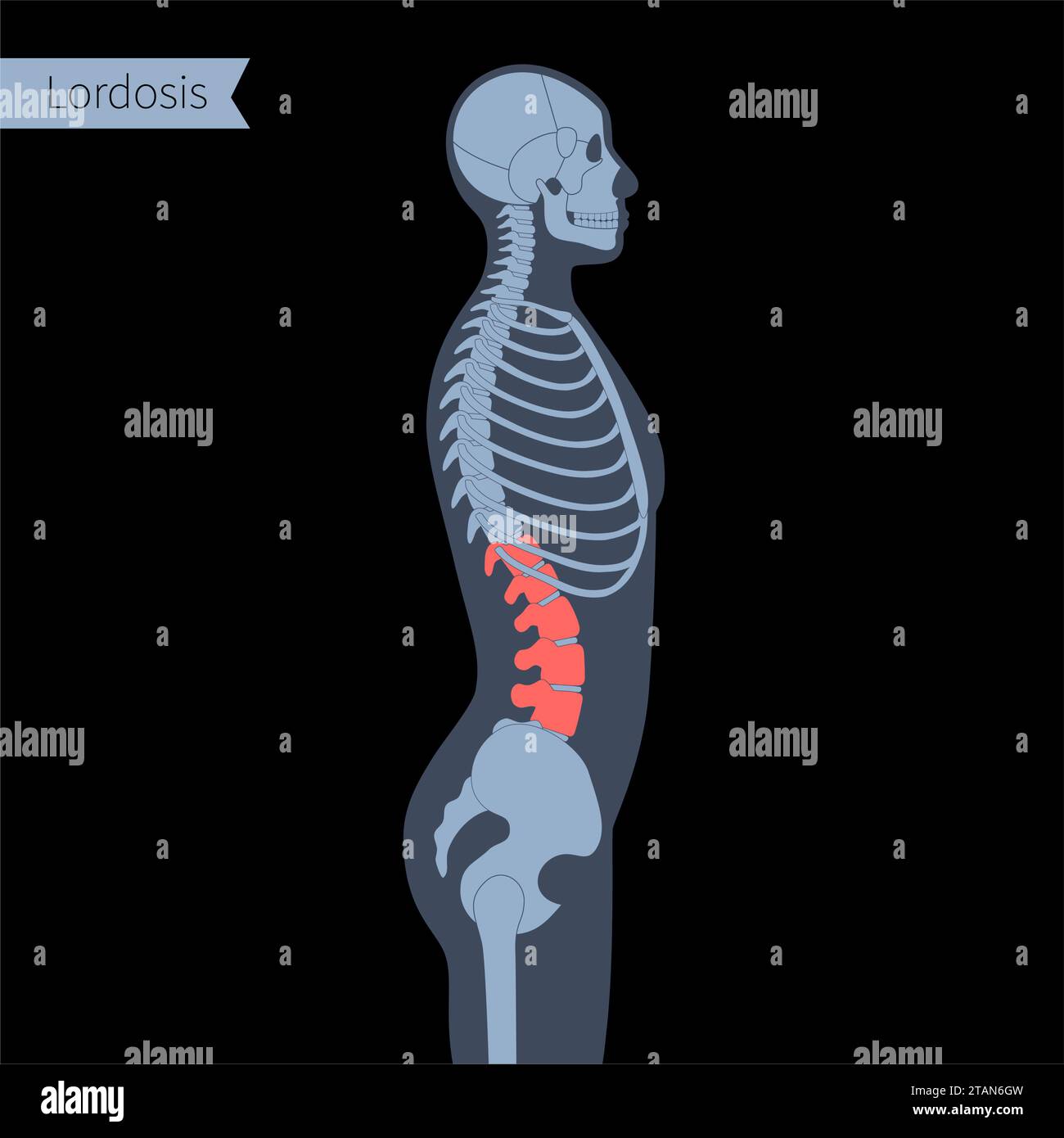 Normale lordose -Fotos und -Bildmaterial in hoher Auflösung – Alamy