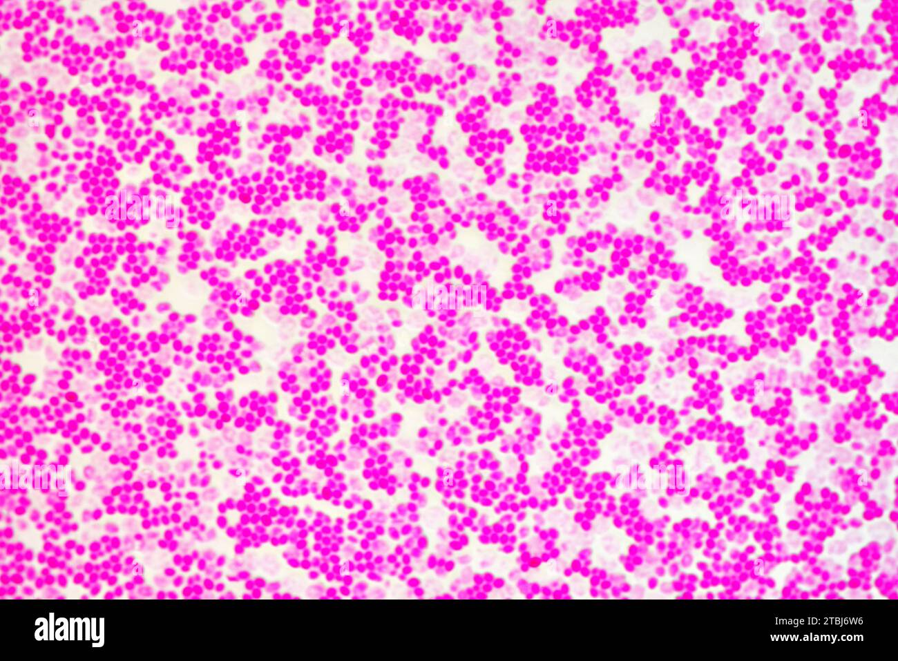 Hefe mikroskop -Fotos und -Bildmaterial in hoher Auflösung – Alamy