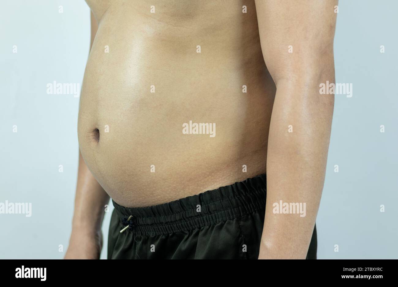 Fette bäuche -Fotos und -Bildmaterial in hoher Auflösung – Alamy