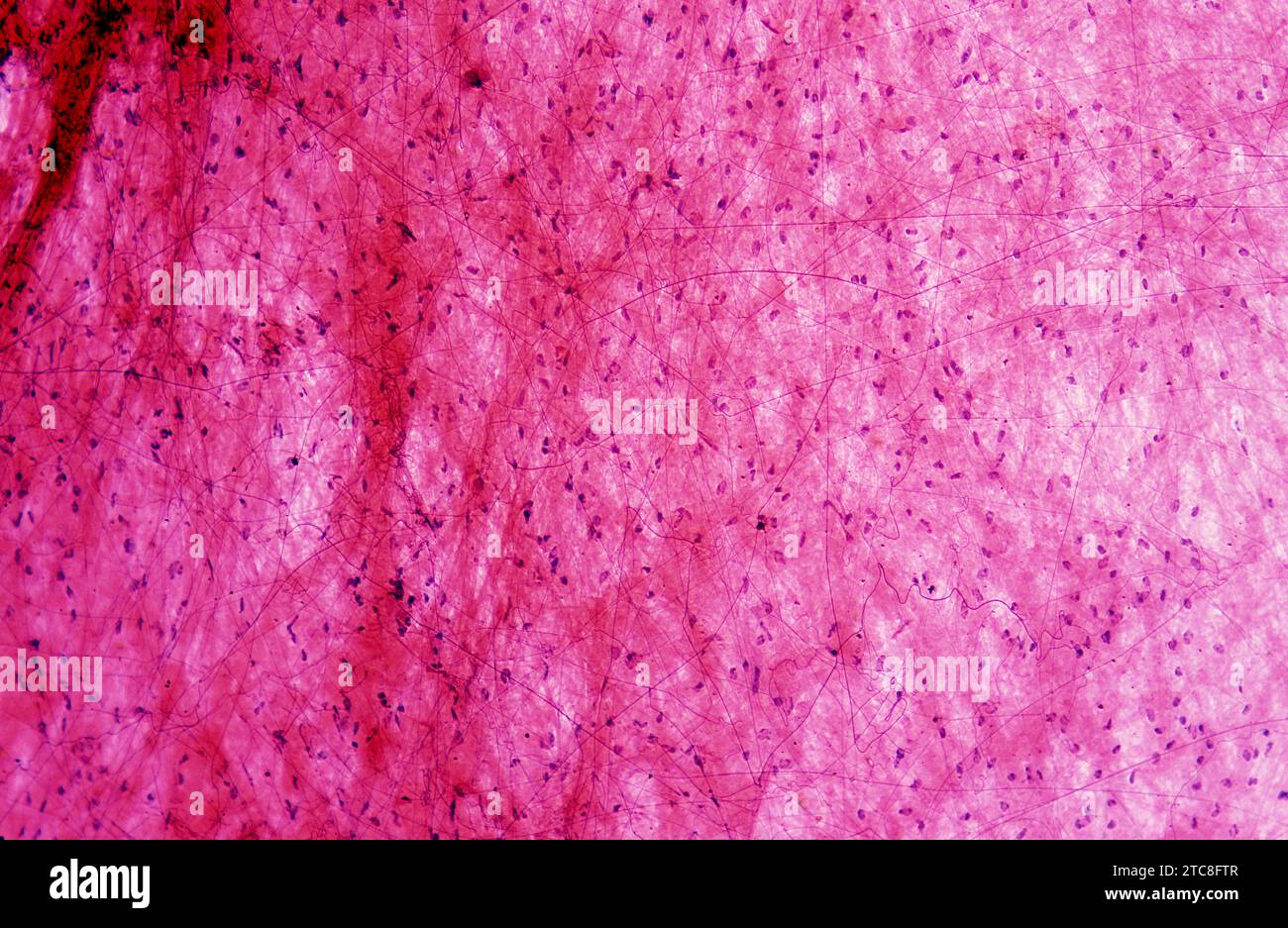 Loses gewebe -Fotos und -Bildmaterial in hoher Auflösung – Alamy