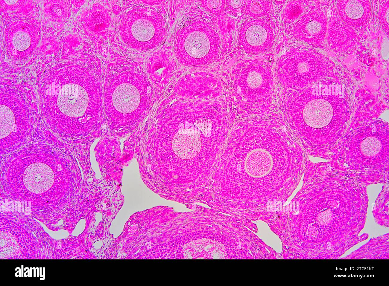 Ovarian follicle histology -Fotos und -Bildmaterial in hoher Auflösung ...