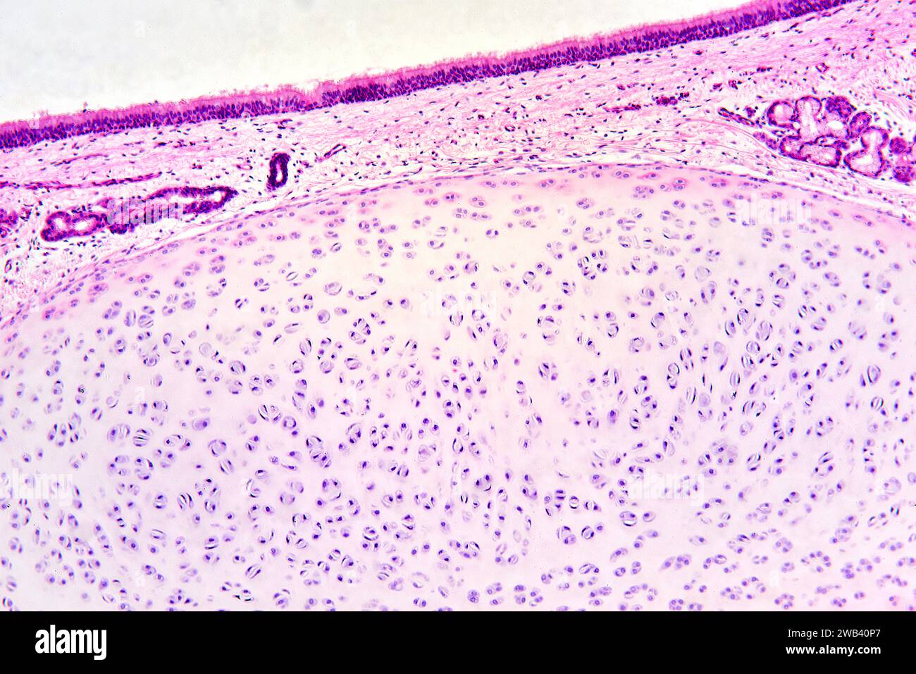 Epitelio respiratorio microscopio -Fotos und -Bildmaterial in hoher ...