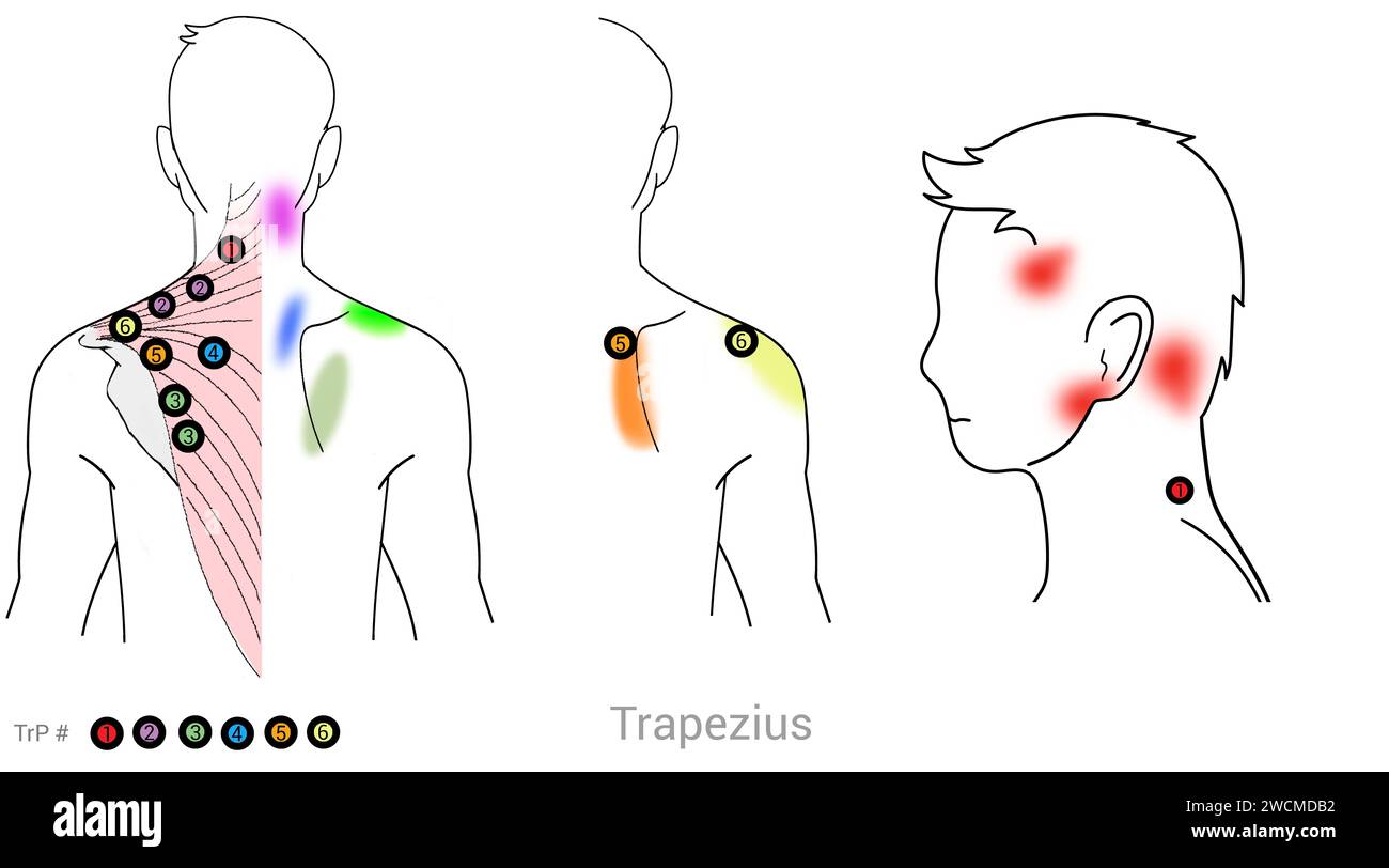 Illustration trapezius muscle anatomy -Fotos und -Bildmaterial in hoher ...