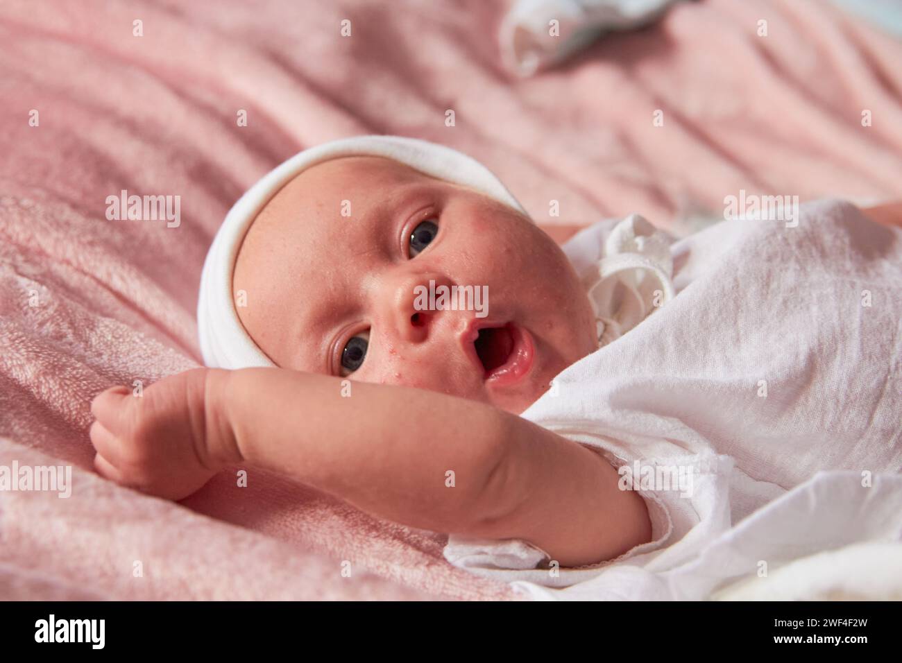 Roter hautausschlag eitriger pickel -Fotos und -Bildmaterial in hoher ...