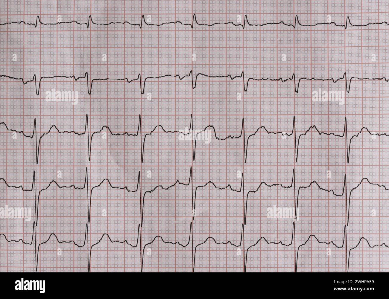 Ekg and cardiogram -Fotos und -Bildmaterial in hoher Auflösung – Alamy