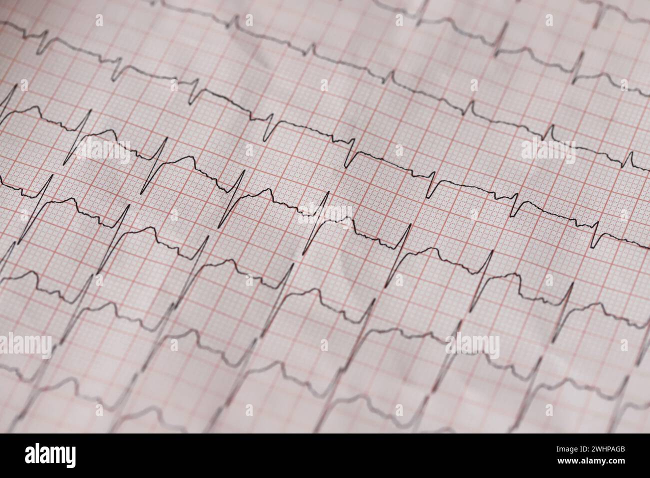 Ekg and cardiogram -Fotos und -Bildmaterial in hoher Auflösung – Alamy