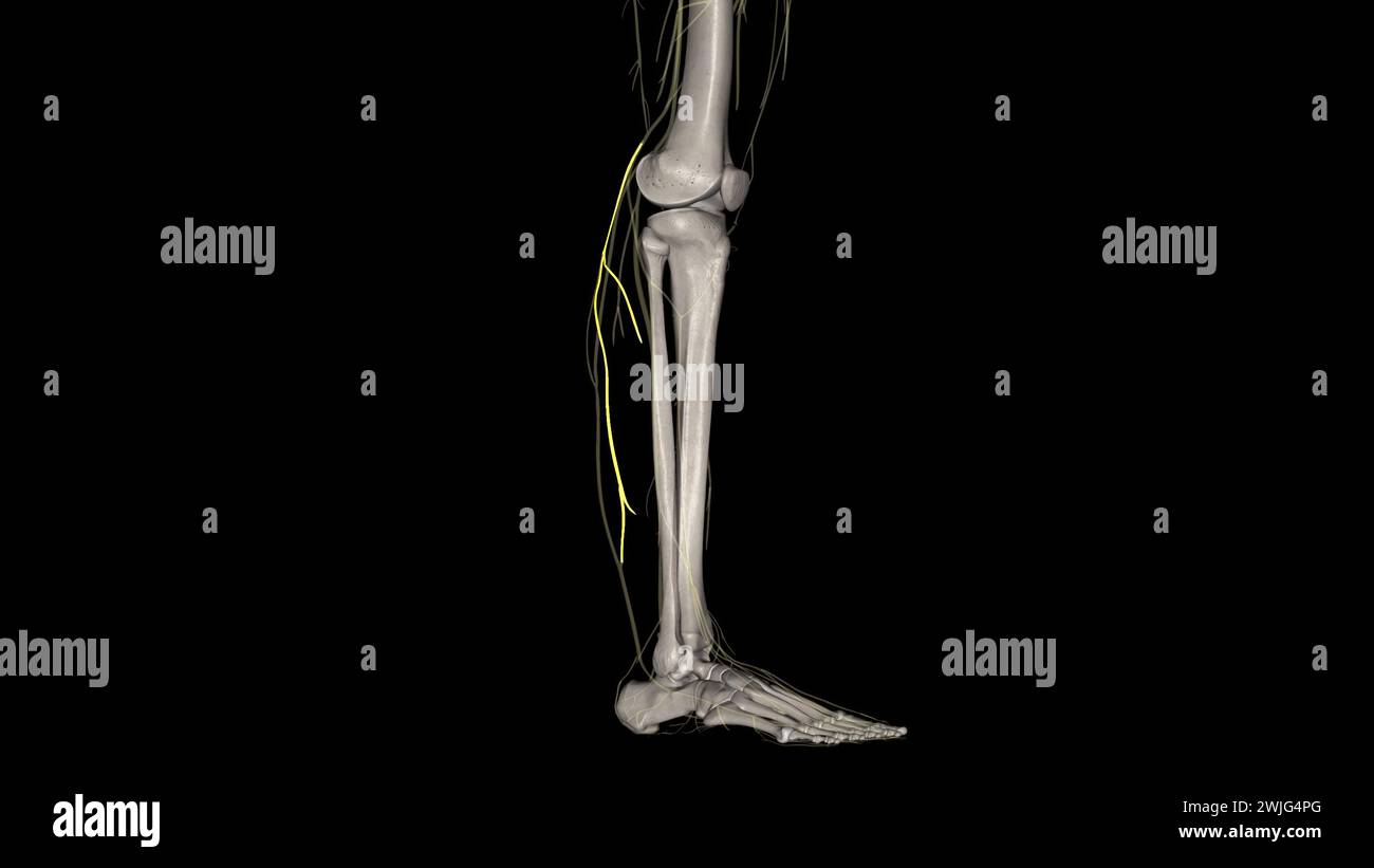 Der Nervus suralis lateralis des Plexus lumbosacralis versorgt die Haut ...