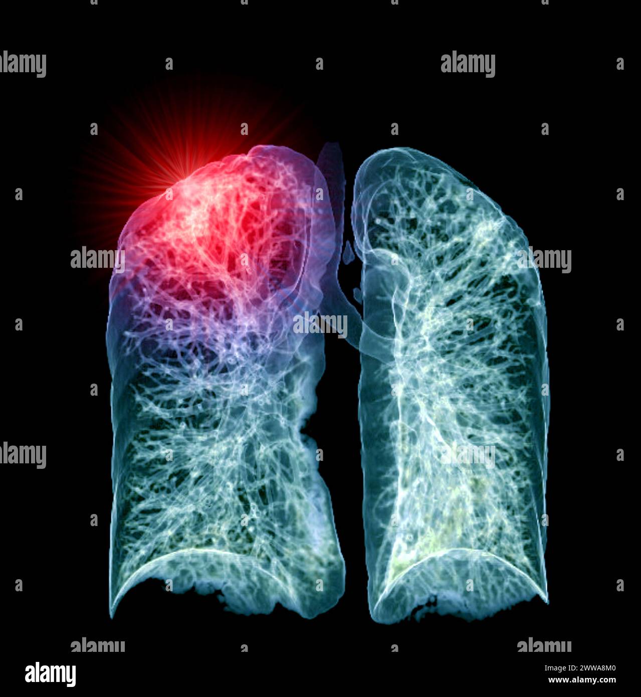 Rechten oberlappen -Fotos und -Bildmaterial in hoher Auflösung – Alamy