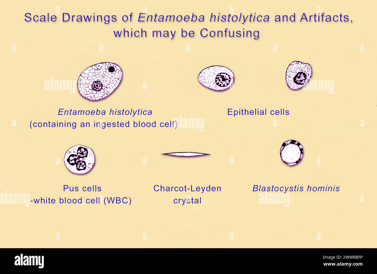 Illustration von Entamoeba histolytica, Epithelzellen, weißen ...