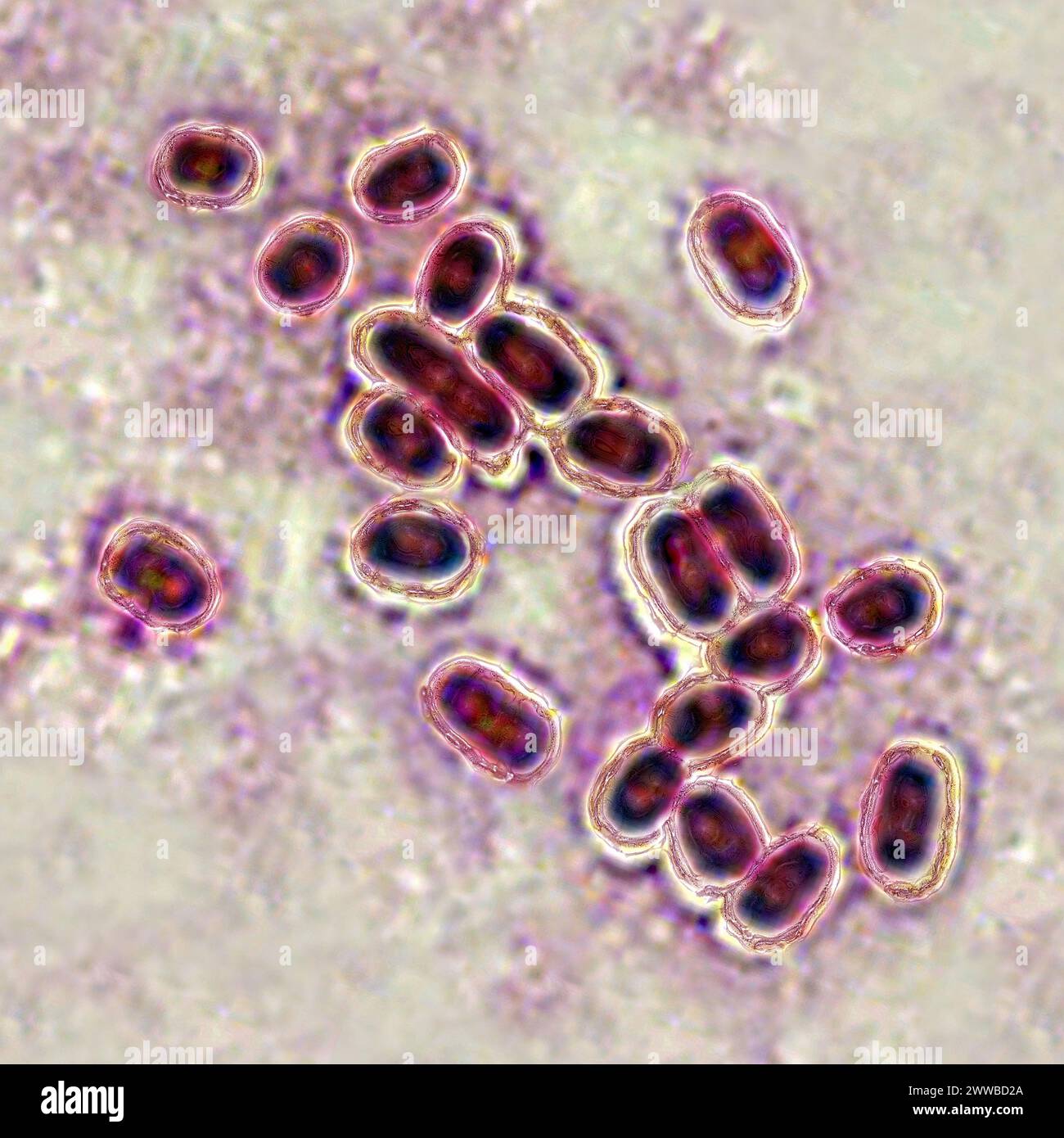 Pneumokokken (Streptococcus pneumoniae), Pneumokokken sind ein ...