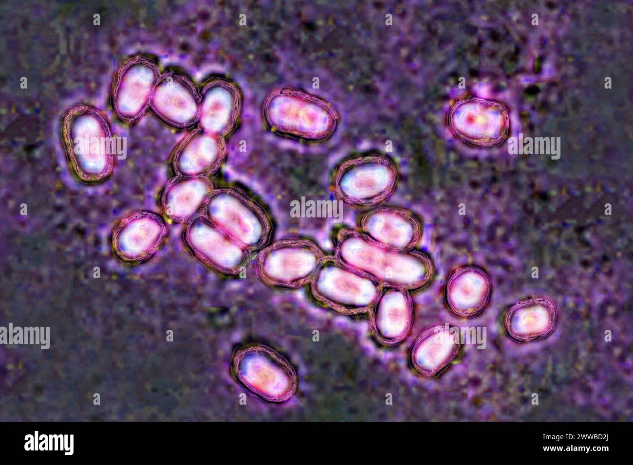 Pneumokokken (Streptococcus pneumoniae), Pneumokokken sind ein ...