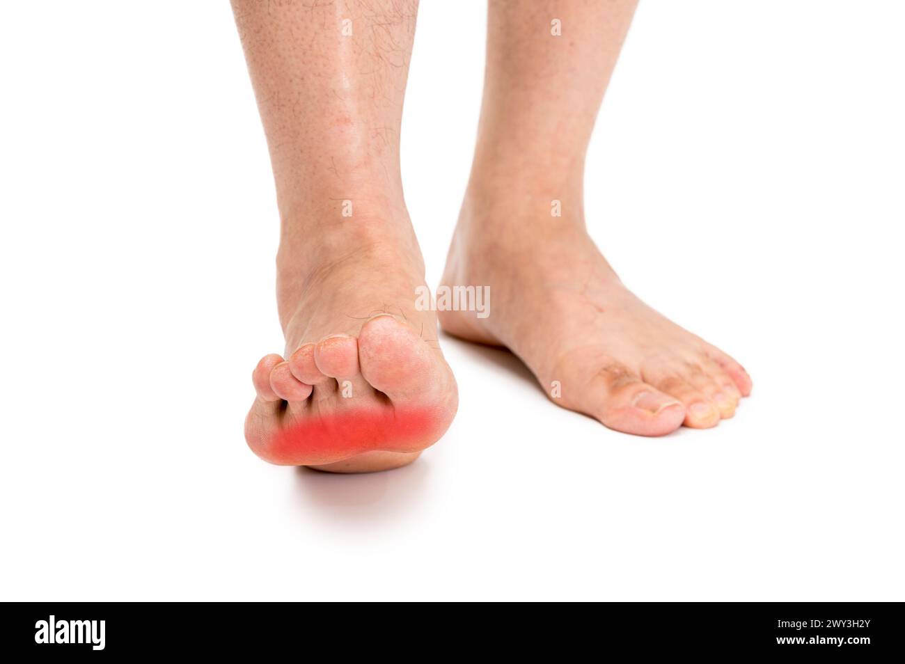 Fuß schmerzen -Fotos und -Bildmaterial in hoher Auflösung – Alamy