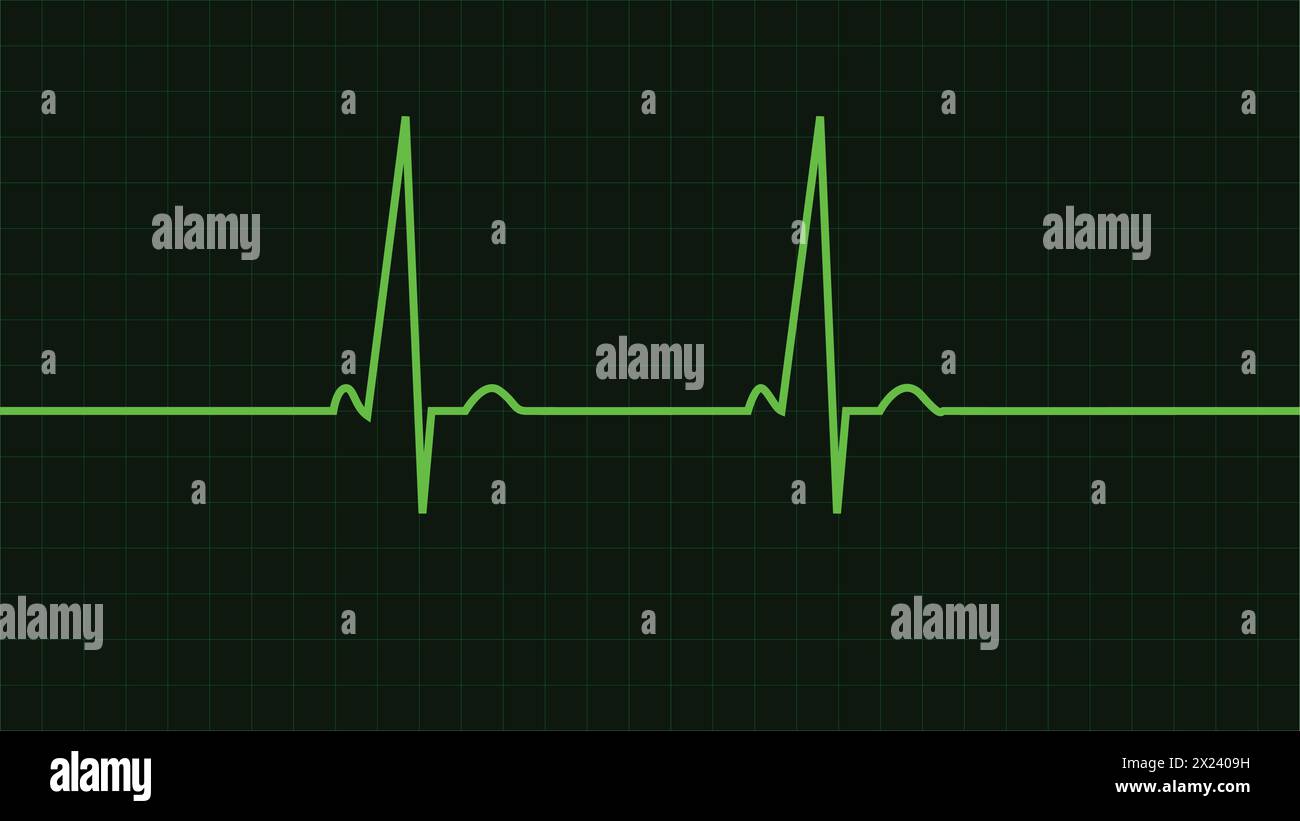 Linea del cardiogramma cardiaco -Fotos und -Bildmaterial in hoher ...