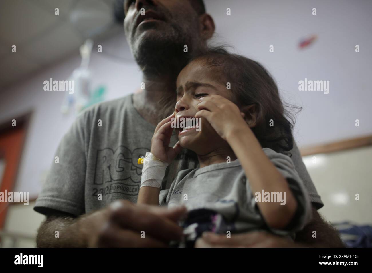 Abdulrahman Al-Rai holds his daughter, Hana Al-Rai, 3, who suffers from ...