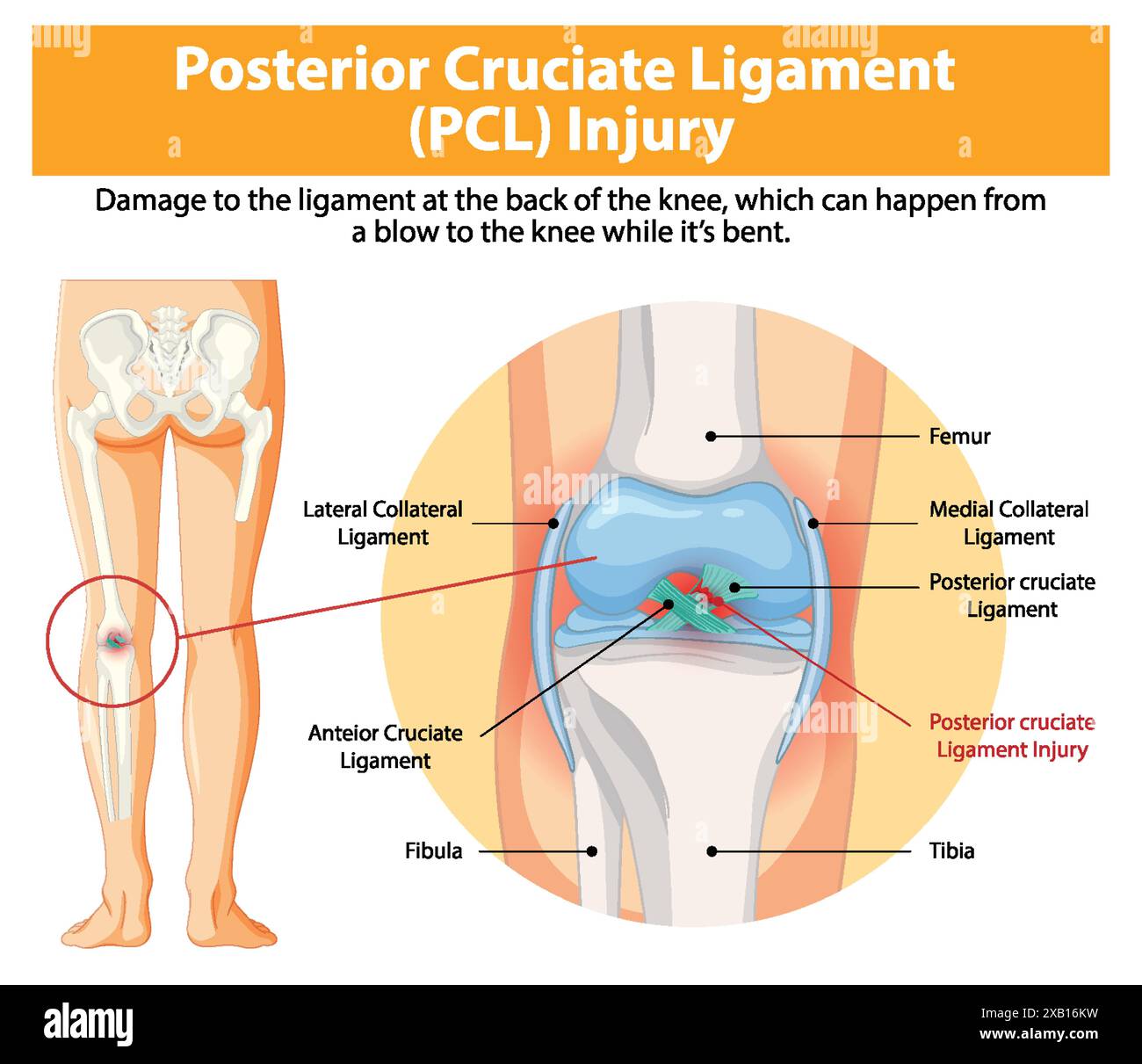 Cruciate ligaments Stock-Vektorgrafiken kaufen - Alamy
